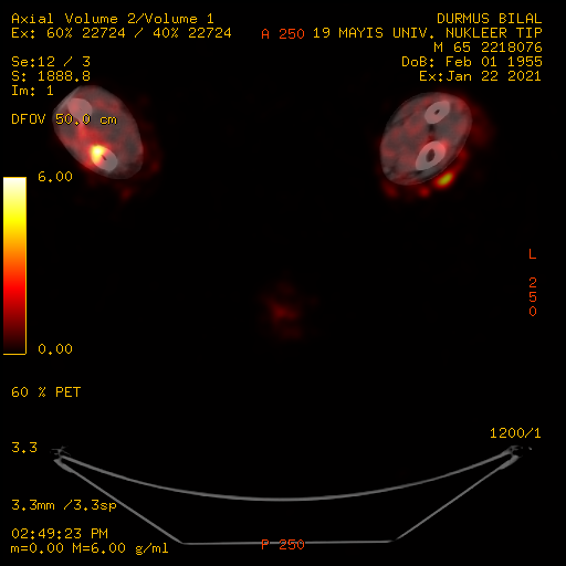 Durmus_Bilal Object Detection Dataset by Akcigerkanseri2