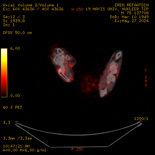 Eren Refaaddin Object Detection Dataset By Akcigerkanseri2