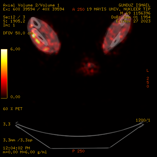 Gunduz İsmail Object Detection Dataset By Akcigerkanseri2