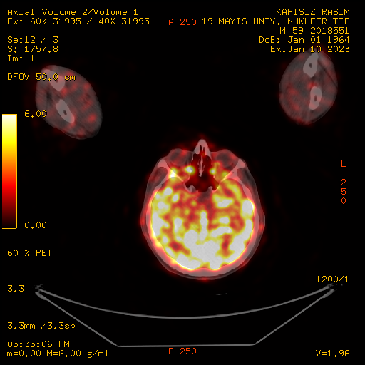 Kapisiz_Rasim Object Detection Dataset by Akcigerkanseri2