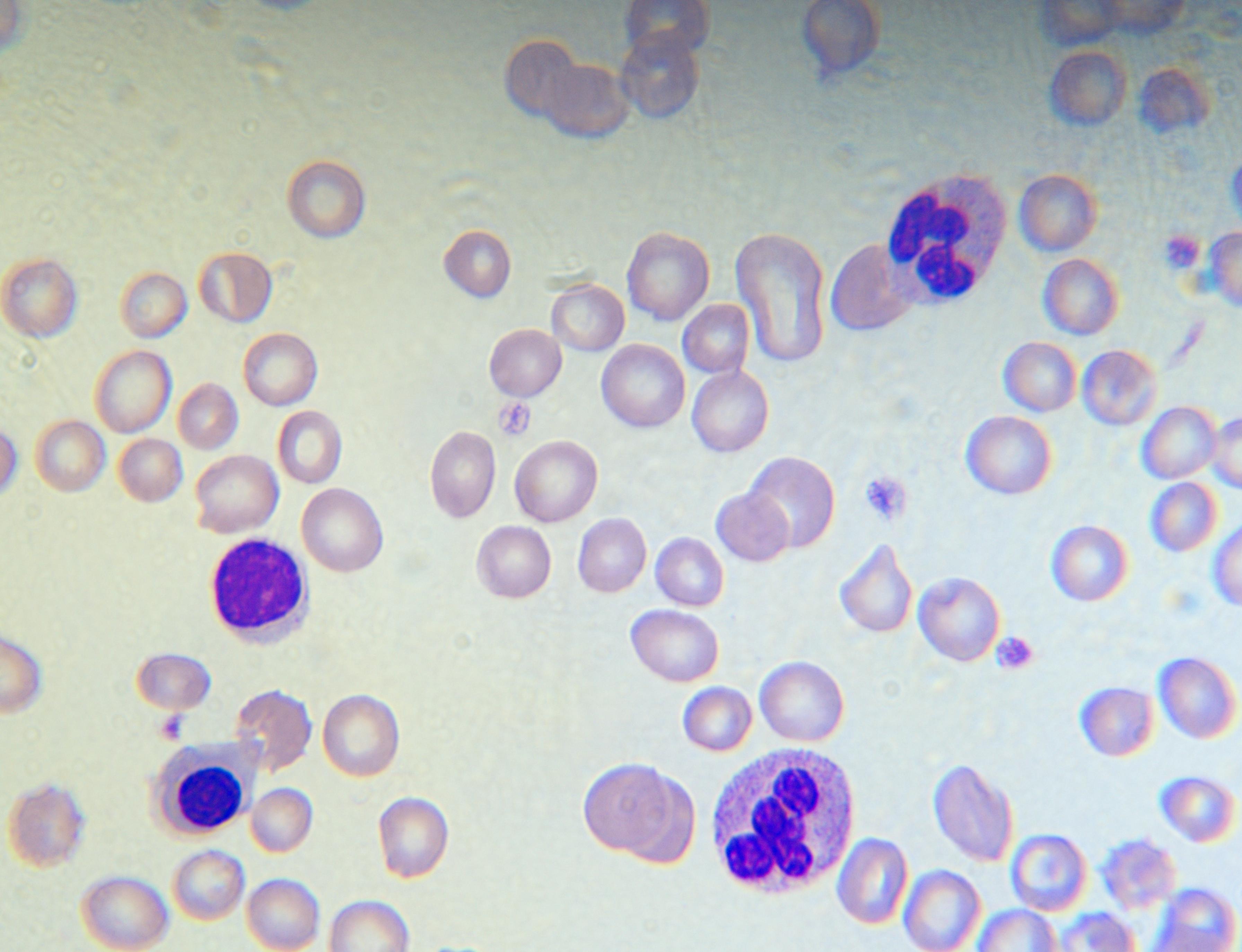 tej_priid_2 Object Detection Dataset and Pre-Trained Model by Motherson ...