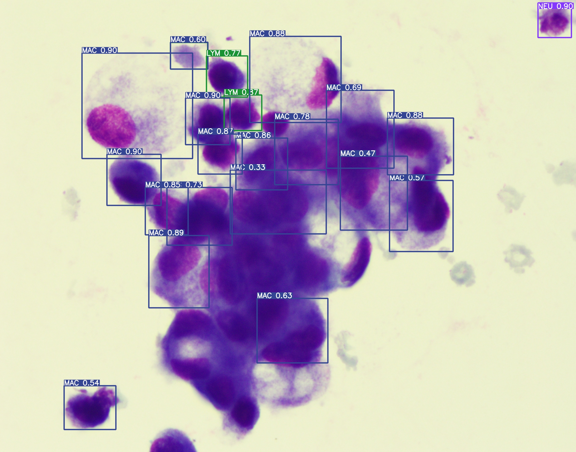 Cells Object Detection Dataset By Zhenyv Wu