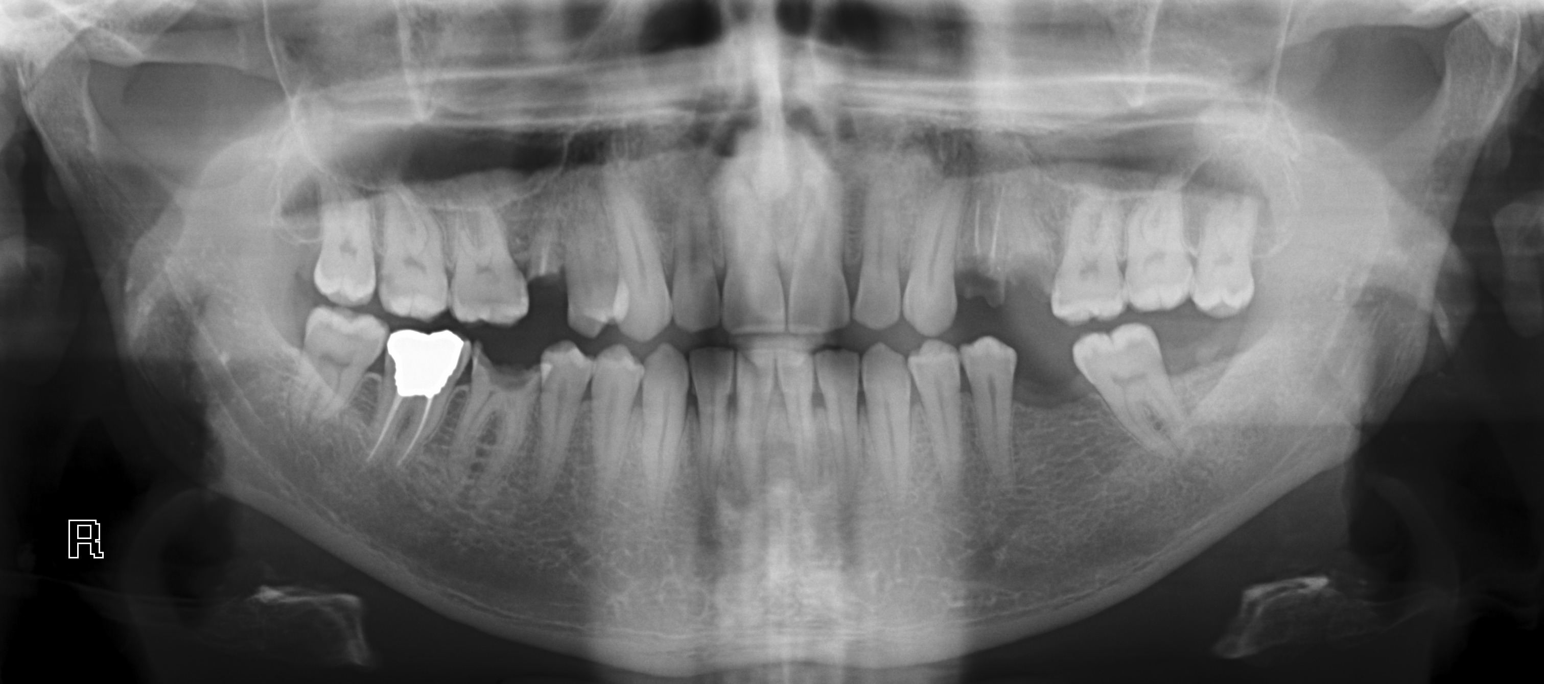 DentalNava Semantic Segmentation Model (v6, 2023-05-28 9:17am) by ...