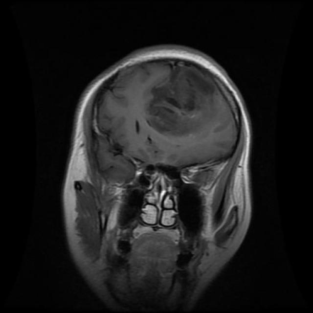 My First Project Instance Segmentation Dataset and Pre-Trained Model by YEN