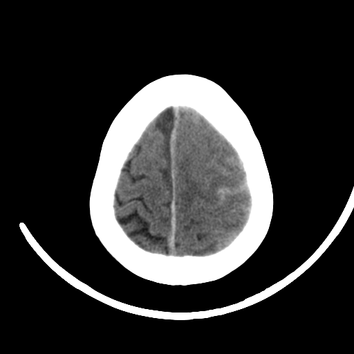 ch4 Object Detection Dataset by ct