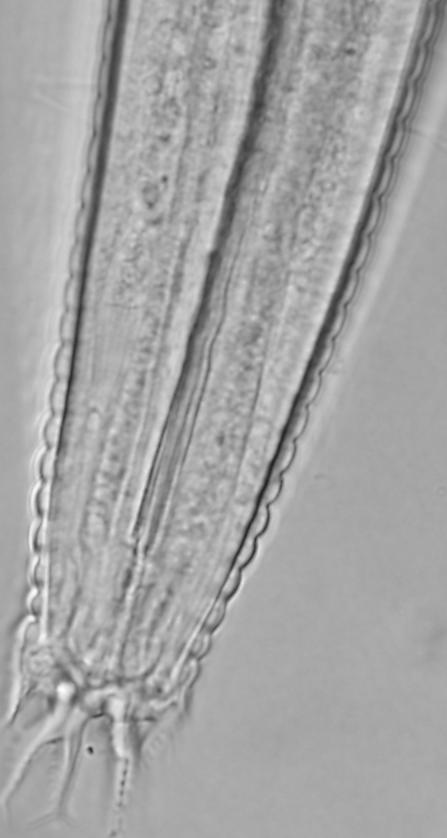 Parasitic Classification Model By Eyasu