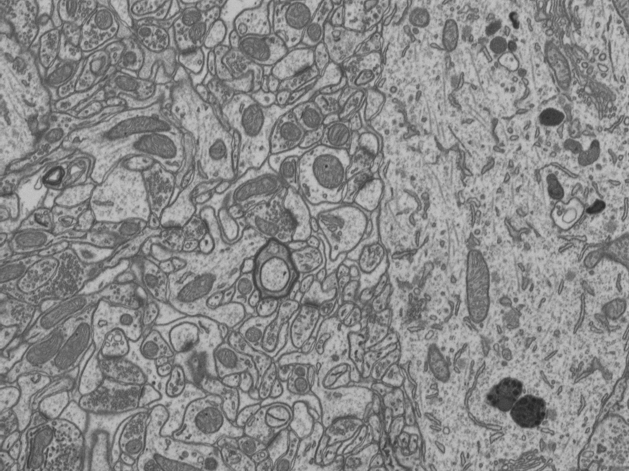 Monil Shah - Roboflow Universe