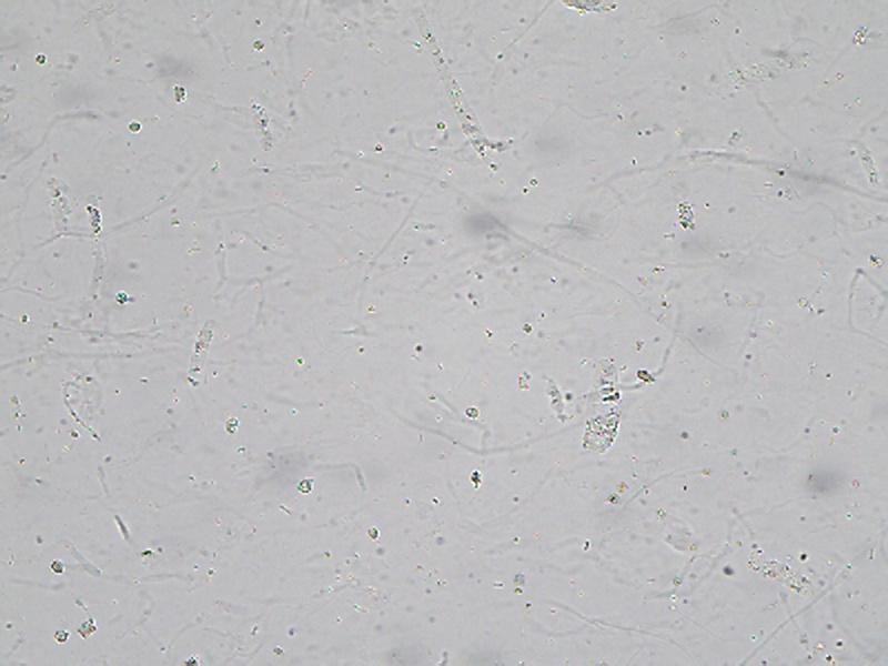 urine-analysis1-q0uii-lwit Object Detection Dataset by Roboflow100VL Full