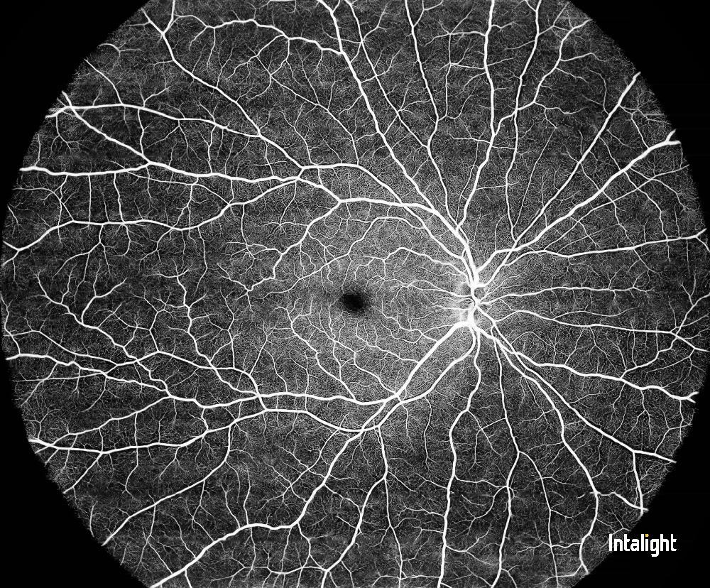 NPA_check_81 Instance Segmentation Model by test