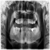 shaden shaden - Roboflow Universe