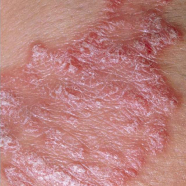 health Object Detection Dataset and Pre-Trained Model by skin