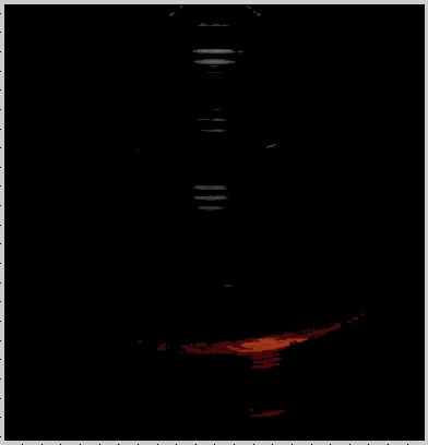 helicalTex 2 Instance Segmentation Dataset by Karim botros