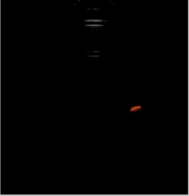 helicalTex 2 Instance Segmentation Dataset by Karim botros