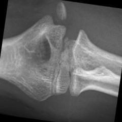 fffffff Classification Dataset by ain shams university