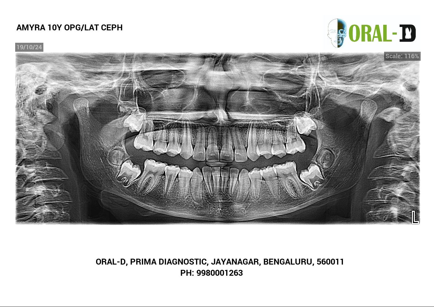 dental ray Object Detection Dataset by dental xrays