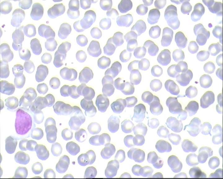 LISC_2_tvt_2 Object Detection Dataset by project-6blex