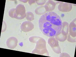 blood_cell Object Detection Dataset by domafordarwin