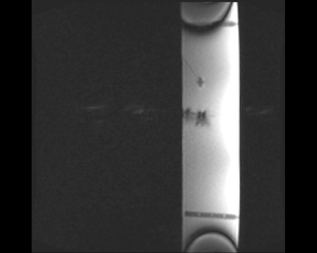 cath-2-orig Instance Segmentation Dataset and Pre-Trained Model by catheter