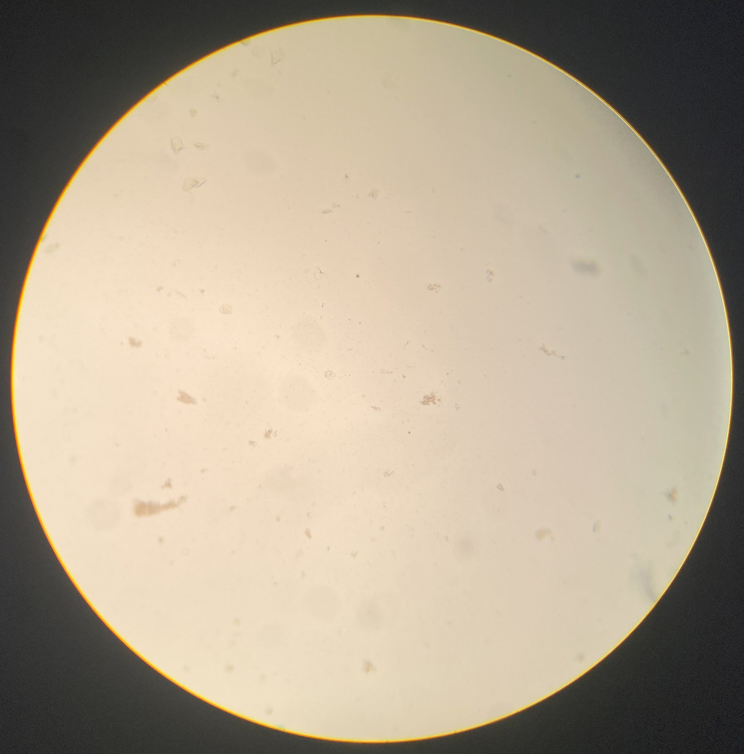 Ecoli Detection Object Detection Dataset And Pre Trained Model By Conrad