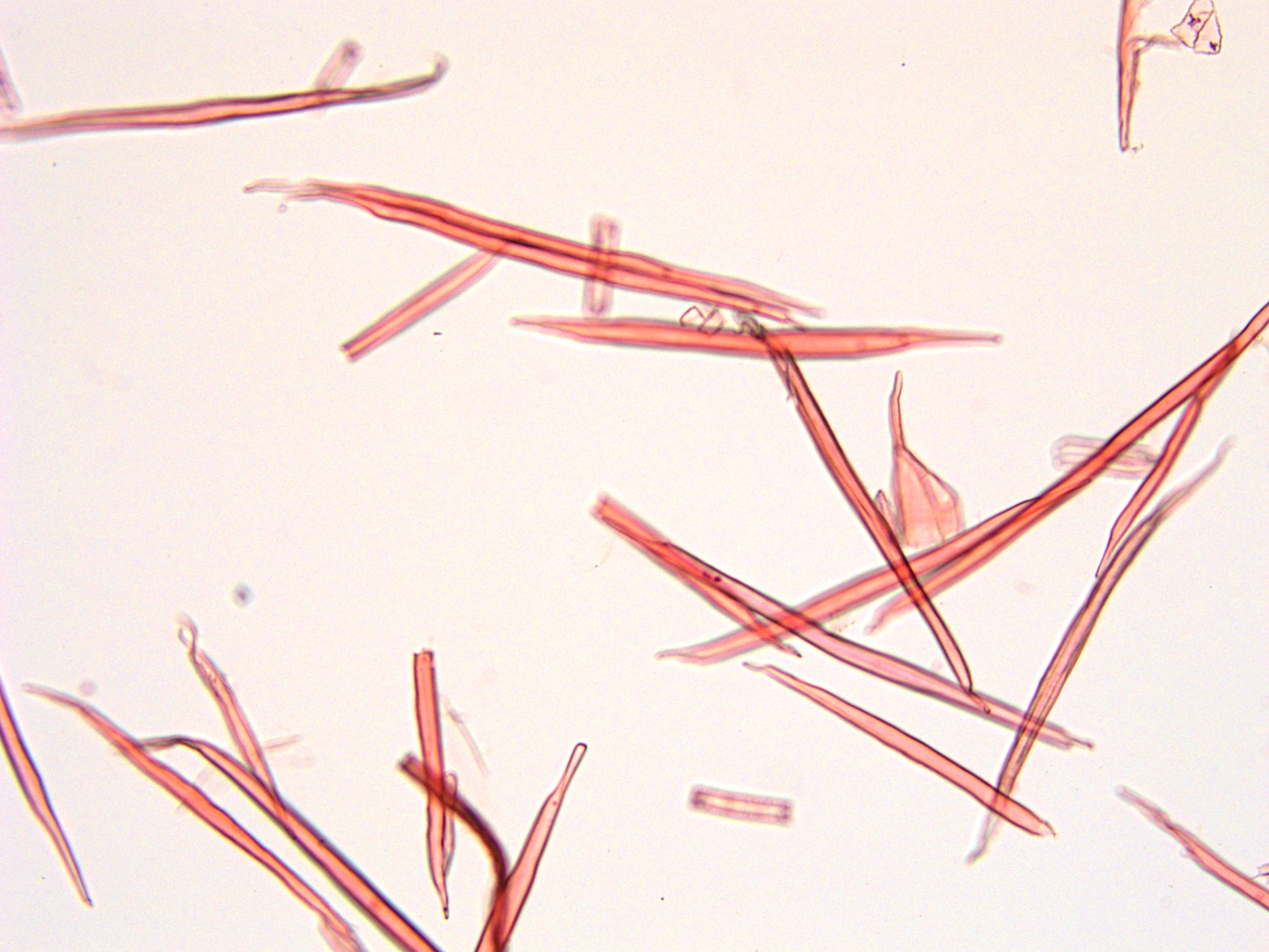wood train Instance Segmentation Dataset by check