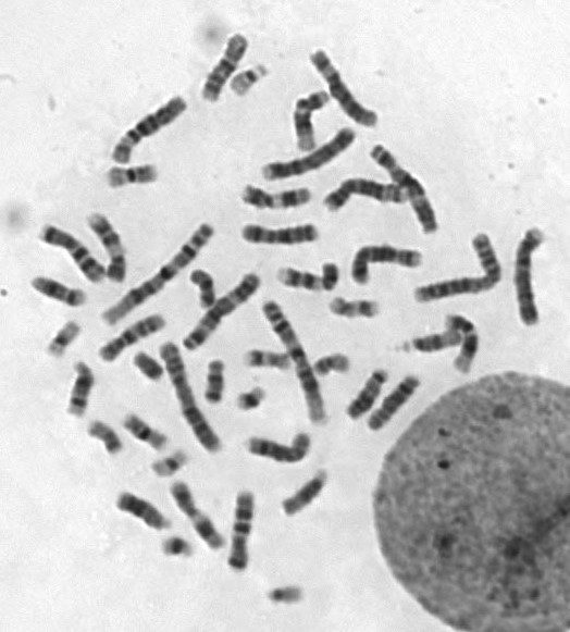 24-chromosomes Classification Dataset by data1