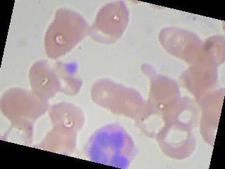 A dataset for microscopic peripheral blood cell images for development ...