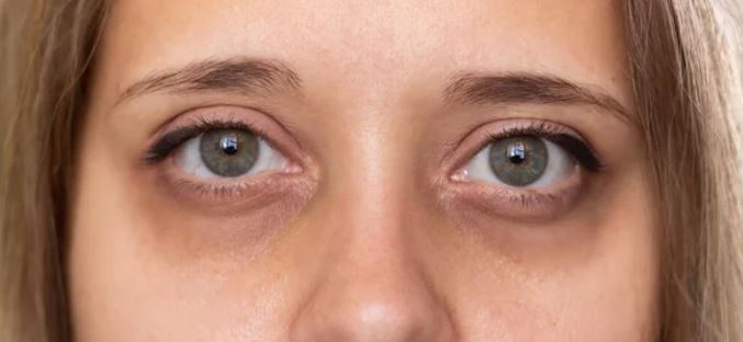 eye Instance Segmentation Dataset by faceimage1