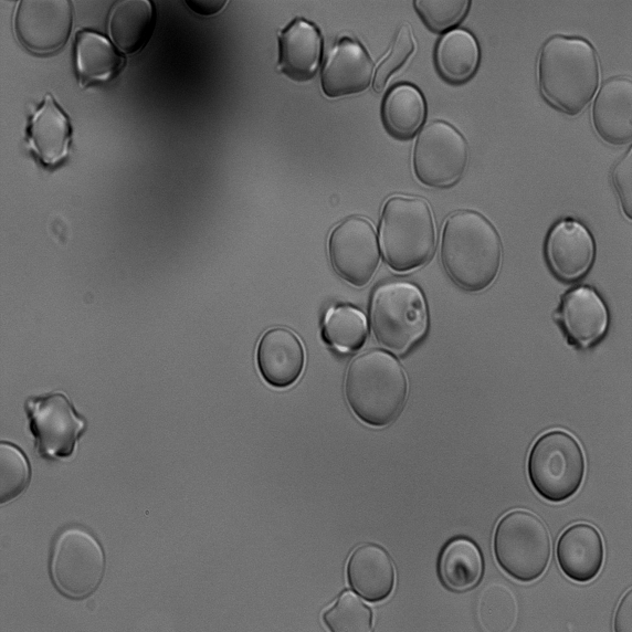 fold3 val Instance Segmentation Dataset by Progress