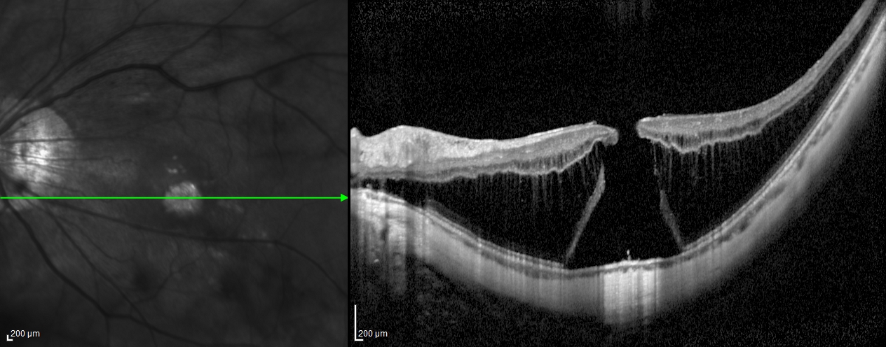 EyeSegment 2 Instance Segmentation Dataset and Pre-Trained Model by ...