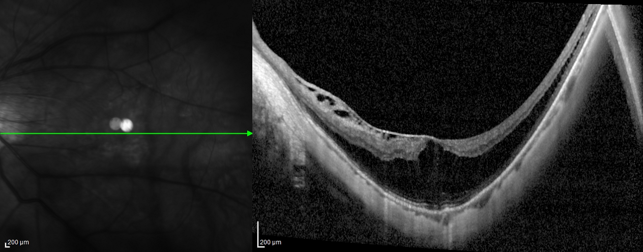 How to Use the Eye Instance Segmentation API