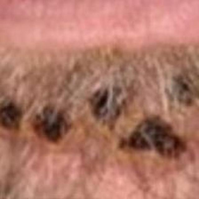 Monkeypox Lesion Detection Object Detection Dataset and Pre-Trained Model by monkeypox