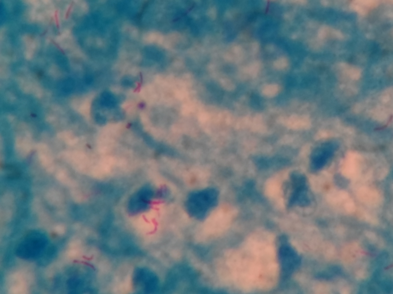 Bacteria Valid Object Detection Dataset by tuberculosis