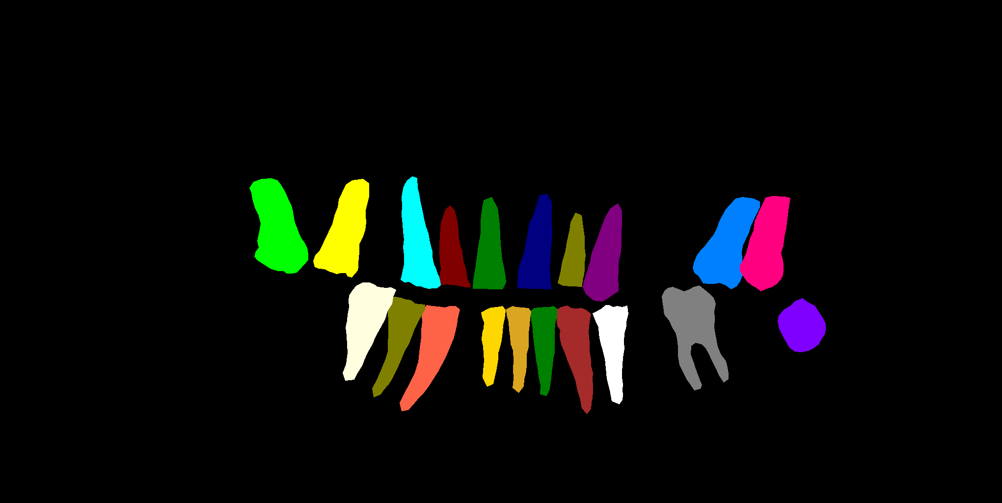 Teeth Segmentation Instance Segmentation Model by Intwish