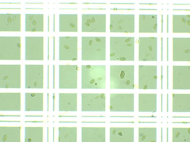 Cell counting microalgae Object Detection Dataset by KPJ Transformer