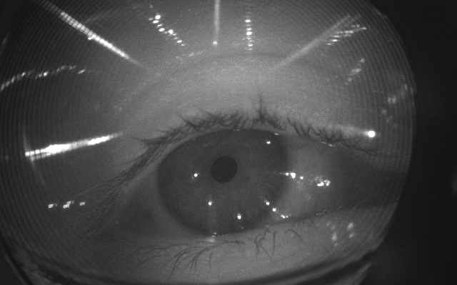 How to Use the Pupil Instance Segmentation Instance Segmentation API