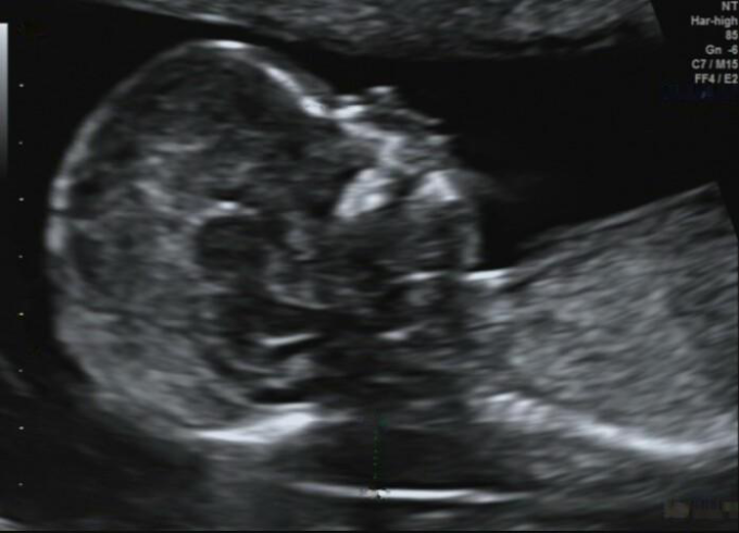 How to Use the nt Instance Segmentation API