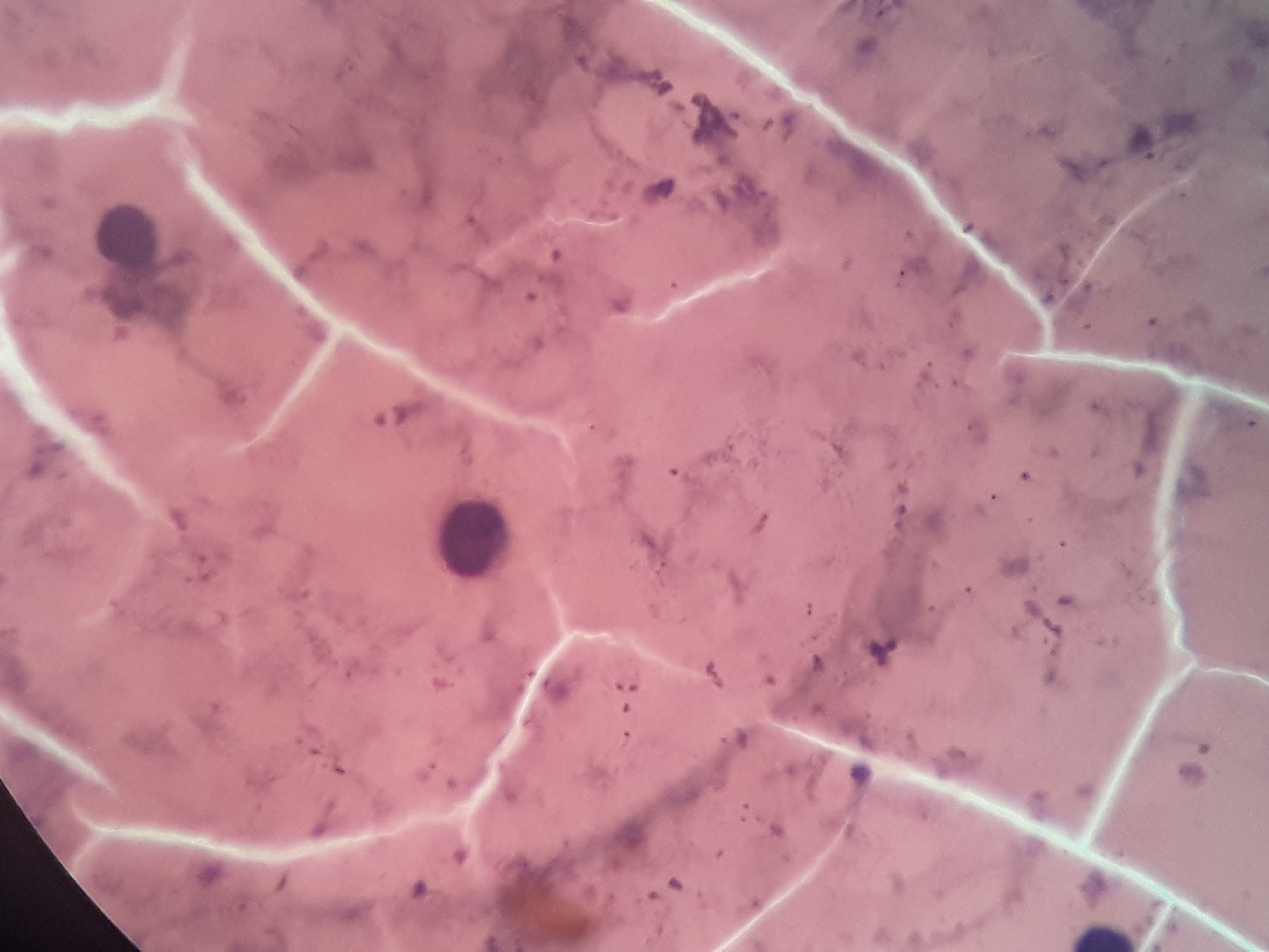 Ocular Object Detection Dataset and Pre-Trained Model by AI for ...