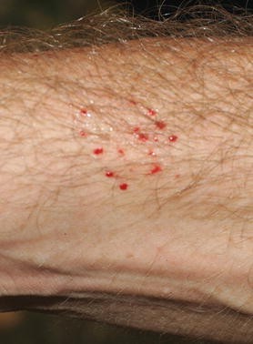 snake bite detection Object Detection Model by snake bite