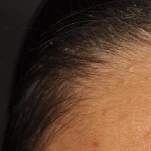 capstone_face 3 Instance Segmentation Dataset by project