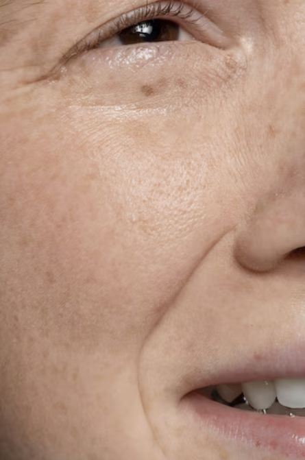 wrinkle Object Detection Dataset by project