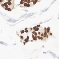 Screw Detection Screw Detection Mkbqa Roboflow Universe