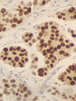 Screw Detection Screw Detection Mkbqa Roboflow Universe