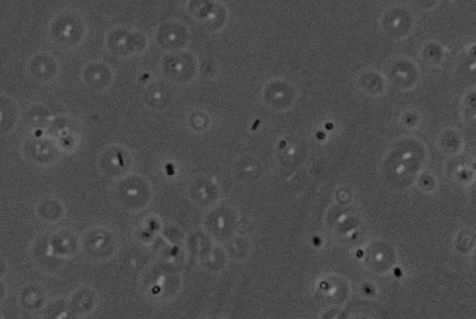 Detection Bacter 8 Micron Object Detection Dataset By Maxim