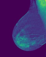 UPM (upm-alyry) - Roboflow Universe