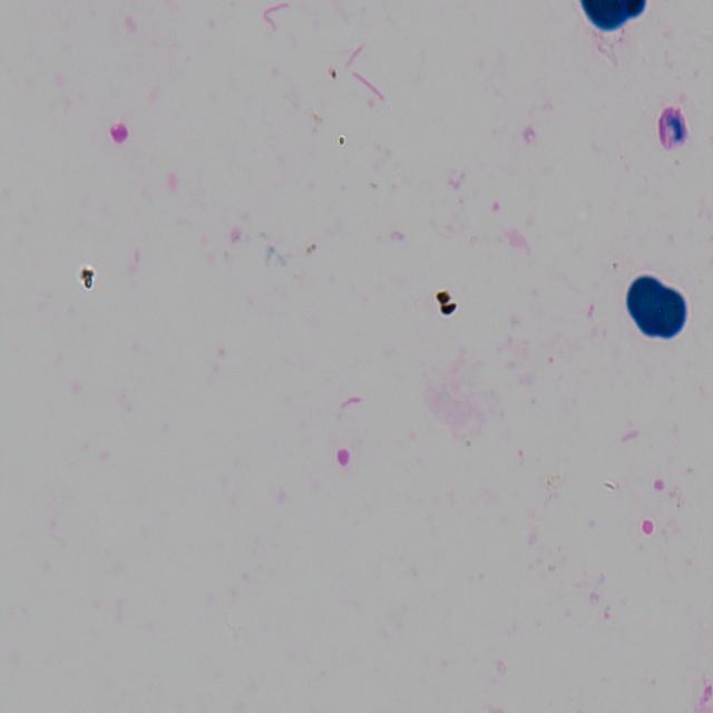 bacteria Object Detection Dataset by thirteenbacteria