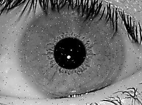 Stress Detection Through Iris Object Detection Dataset by nothing