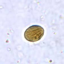 parasite Object Detection Dataset by coco2yolo