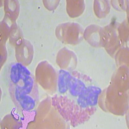 WBC detection Object Detection Dataset by WBC1