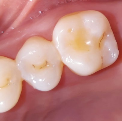 YOLOv7 Instance Segmentation Model by Q