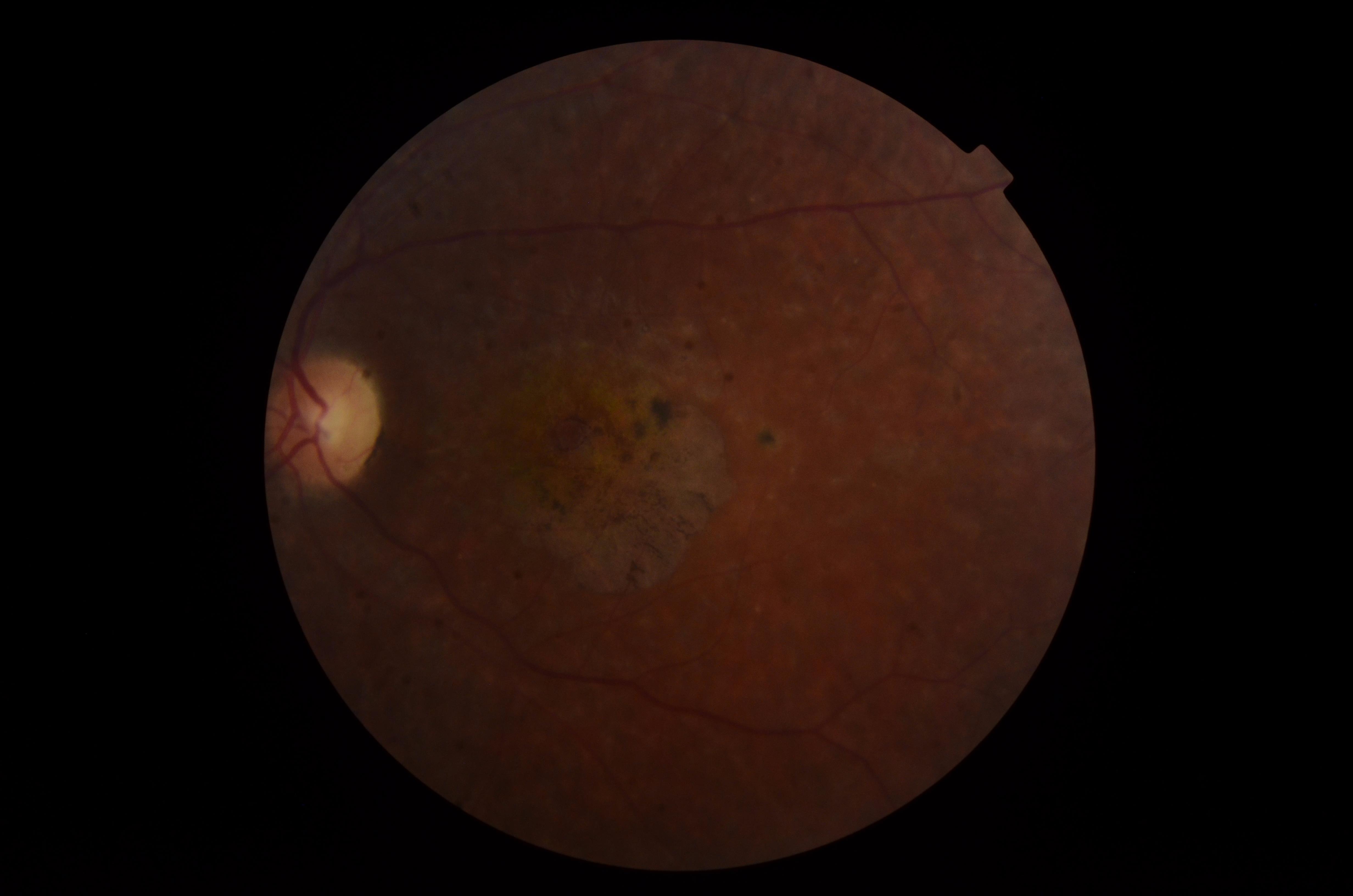 fundos Instance Segmentation Dataset by Machine